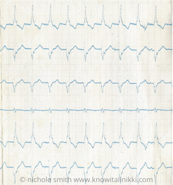 February Book Picks Celebrate Heart Month and CHD Awareness - Know-it ...